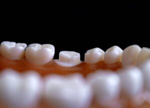 Japan’s Tooth Regrowth Drug: How a Real-Life ‘Third Set of Teeth’ Could ...